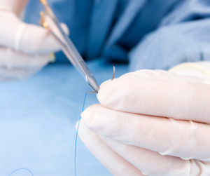 Deep Skin Laceration Treatment - Modern Urgent Care