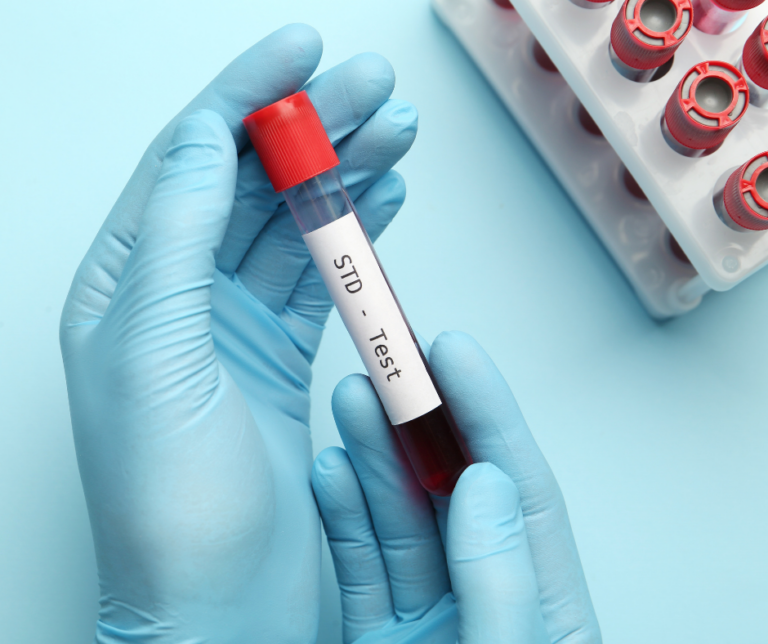 STD and STI Testing - Modern Urgent Care